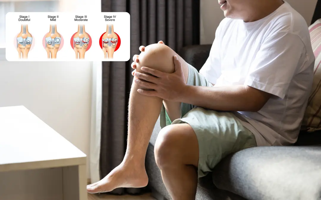 What Are The 4 Stages Of Osteoarthritis? Can Ayurveda Provide Relief In ...